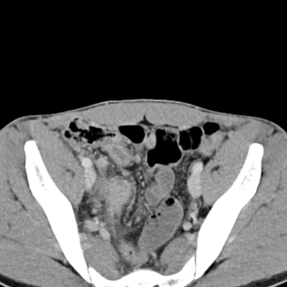 Case #3 - CaseStacks.com