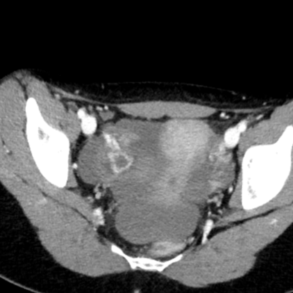 Case #4 - CaseStacks.com
