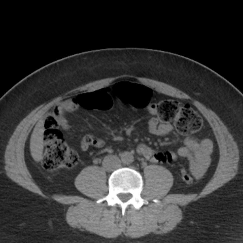 Case #5 - CaseStacks.com