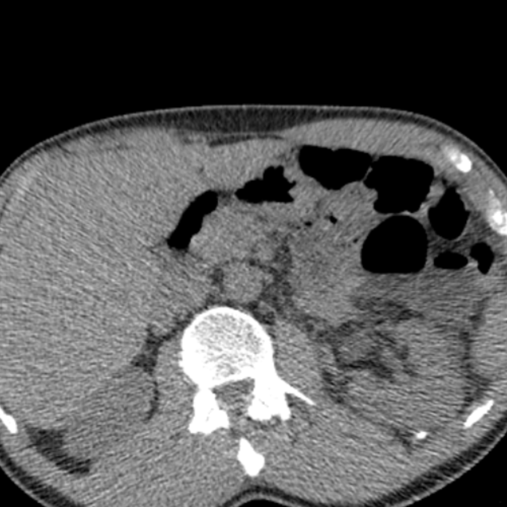 Case #7 - CaseStacks.com