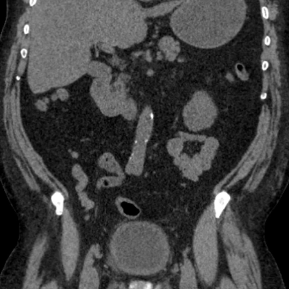 Case #8 - CaseStacks.com