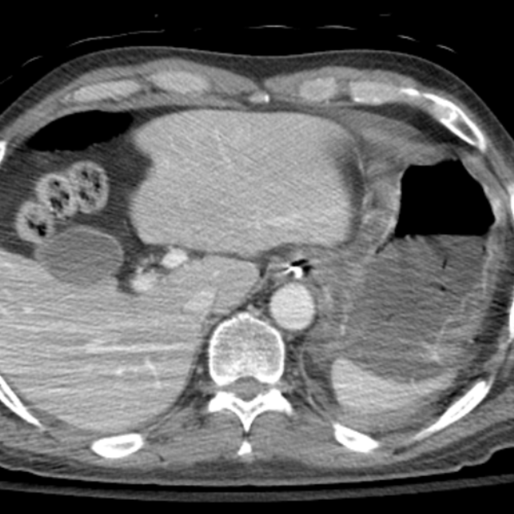 Case #9 - CaseStacks.com