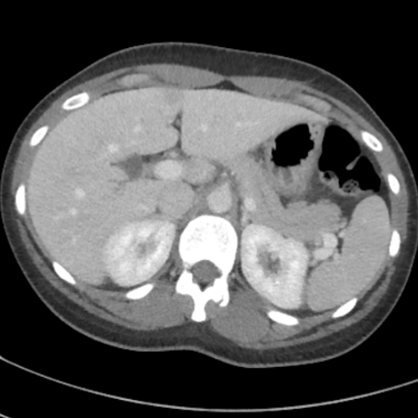 Case #6 - CaseStacks.com