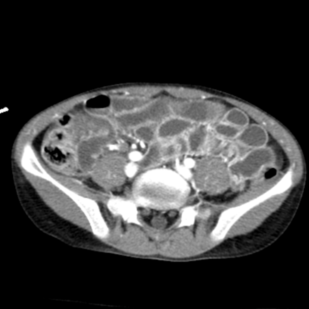 Case #12 - CaseStacks.com