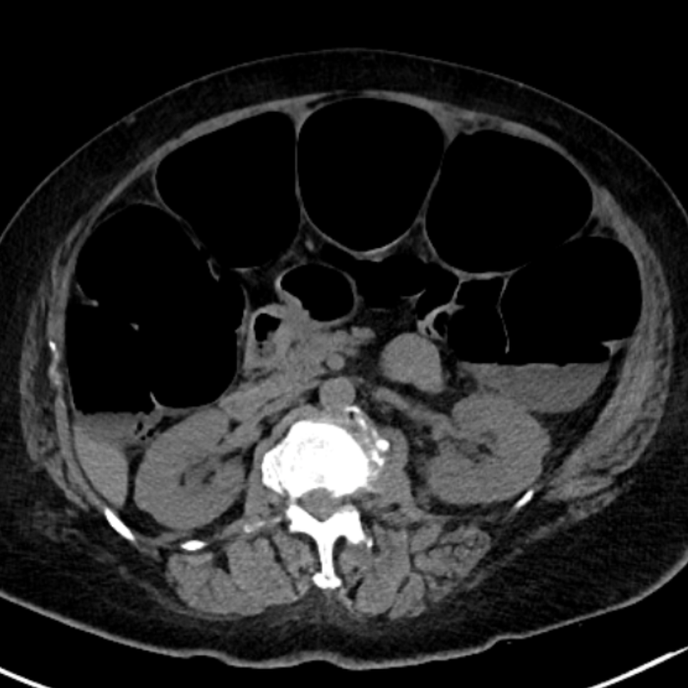 Case #14 - CaseStacks.com