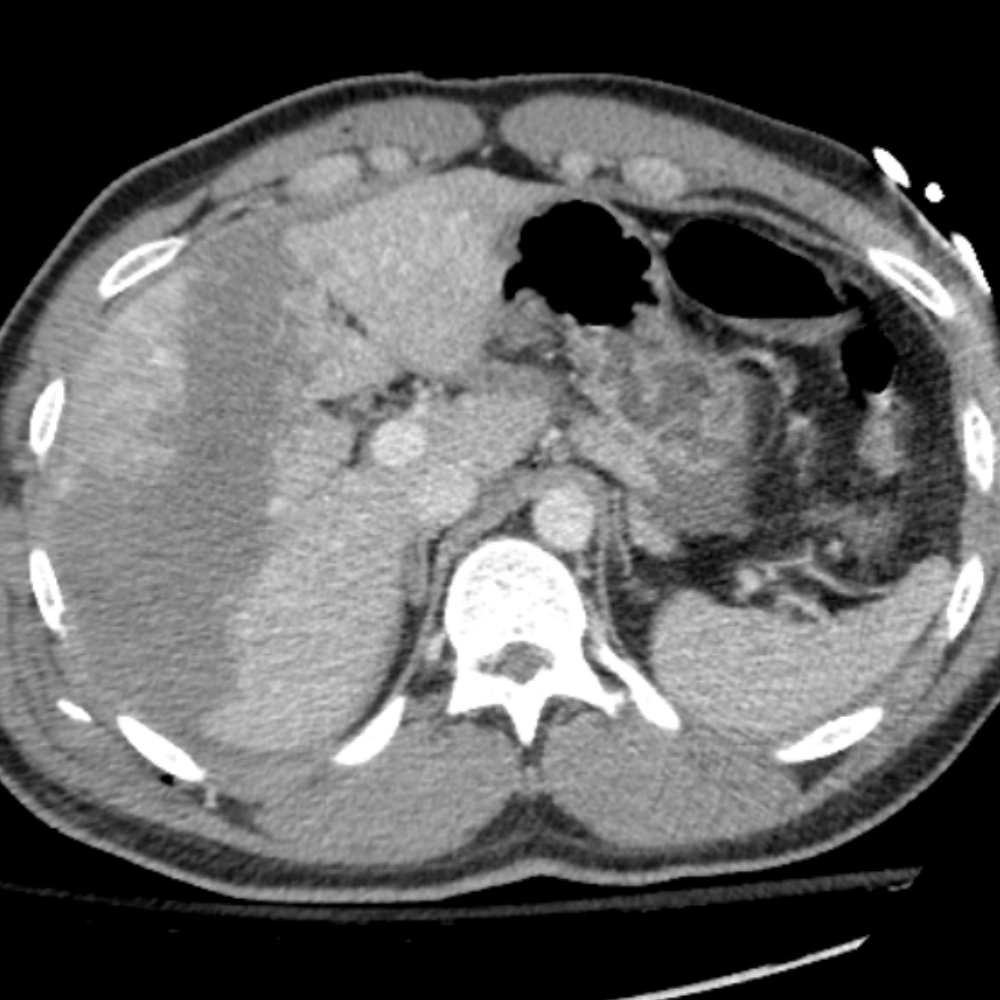 CaseStacks.com - Body-CT Case #19