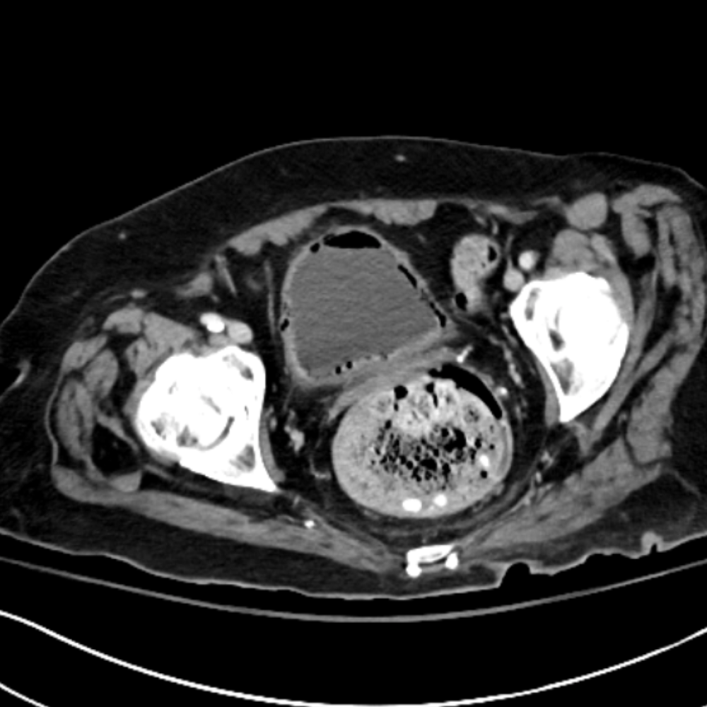 Case #20 - CaseStacks.com