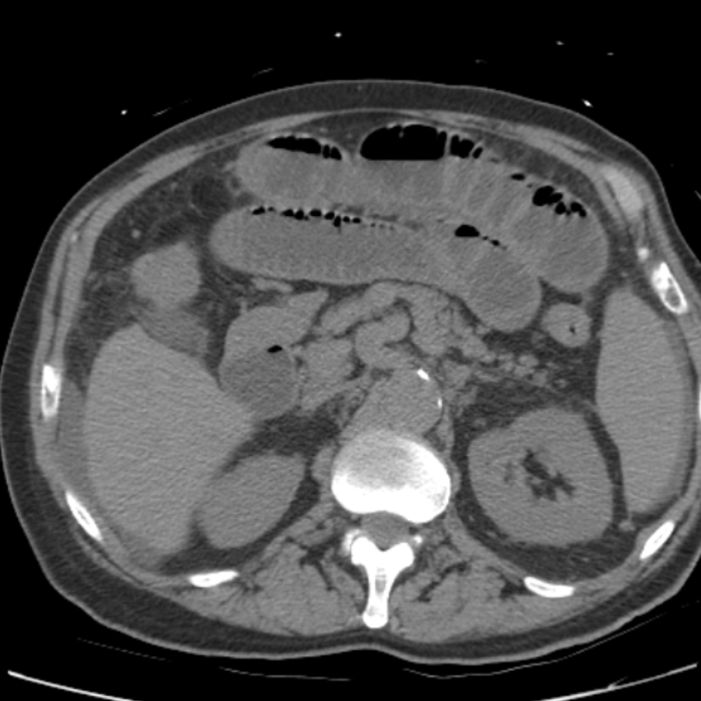 Case #24 - CaseStacks.com