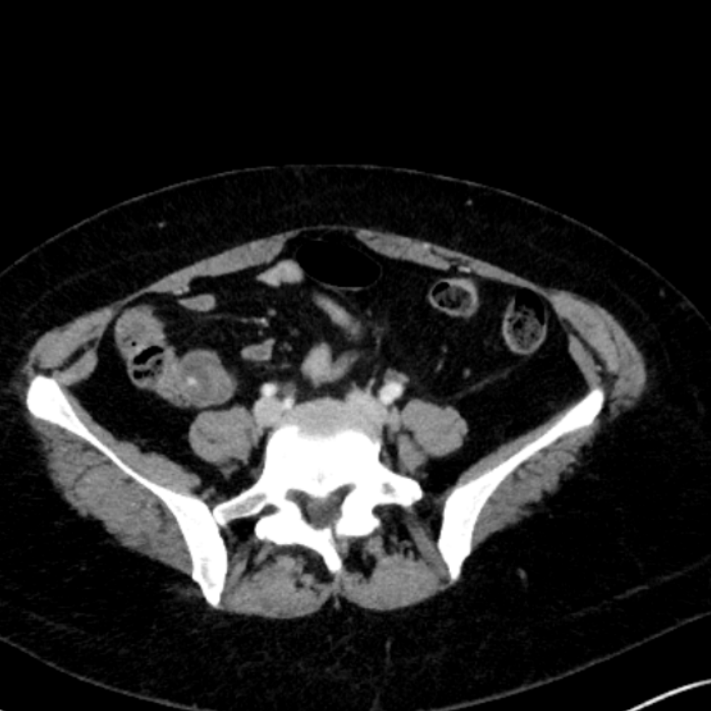 Case #3 - CaseStacks.com