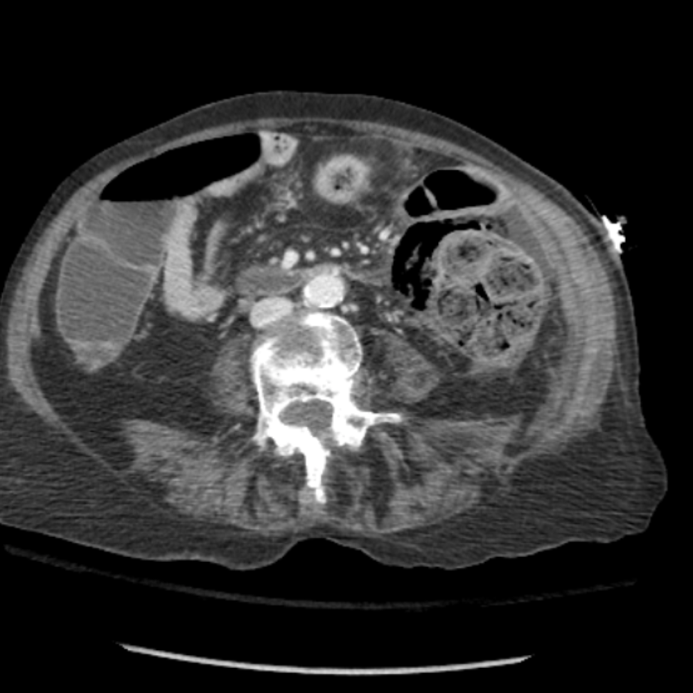 Case #41 - CaseStacks.com