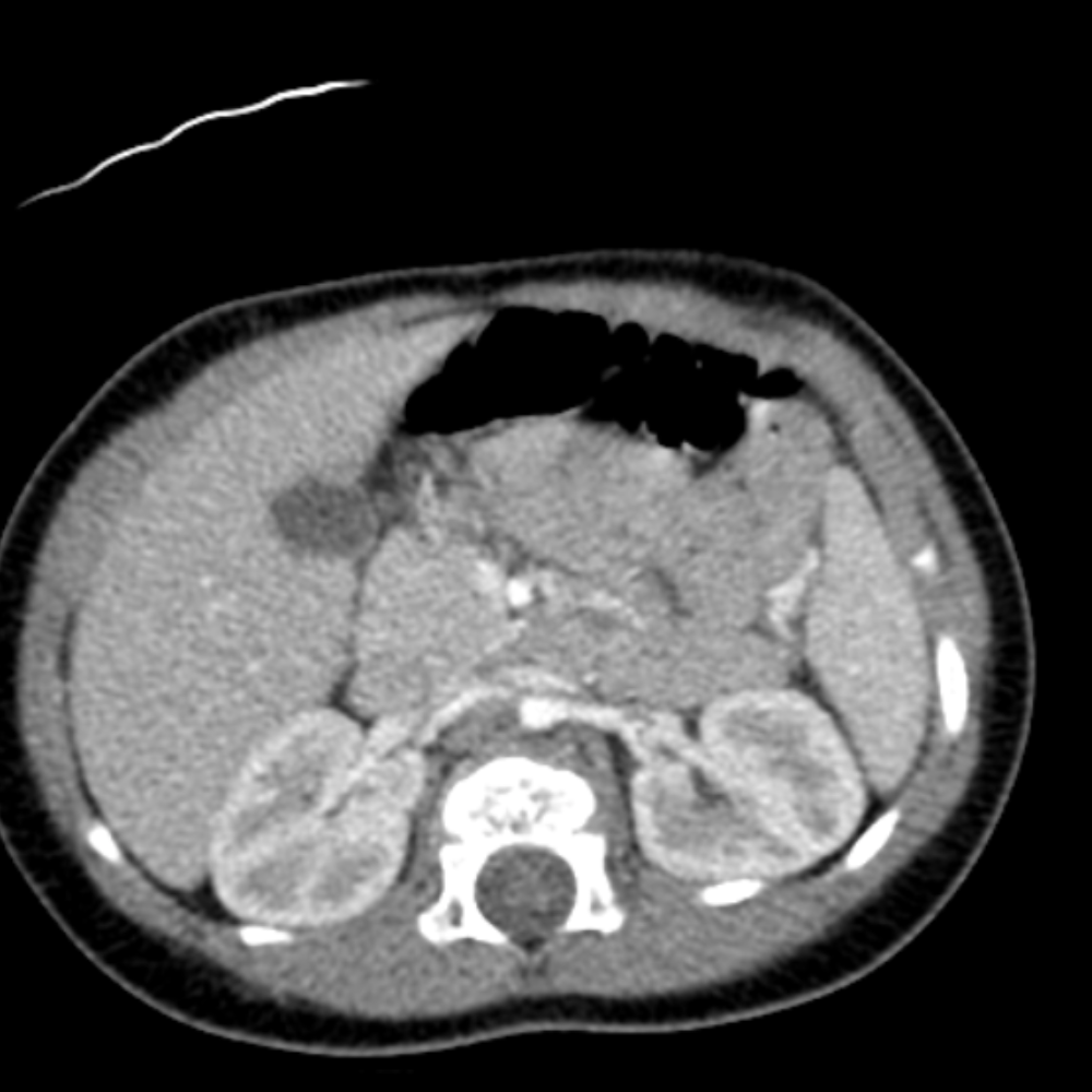 CaseStacks.com - Body-CT Case #47