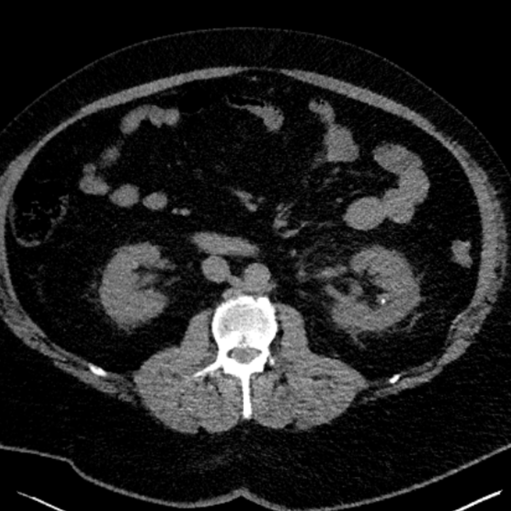 Case #53 - CaseStacks.com