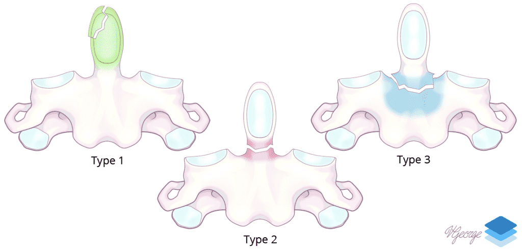 CaseStacks.com - Neuroradiology CT Illustrations, Diagrams, and Videos