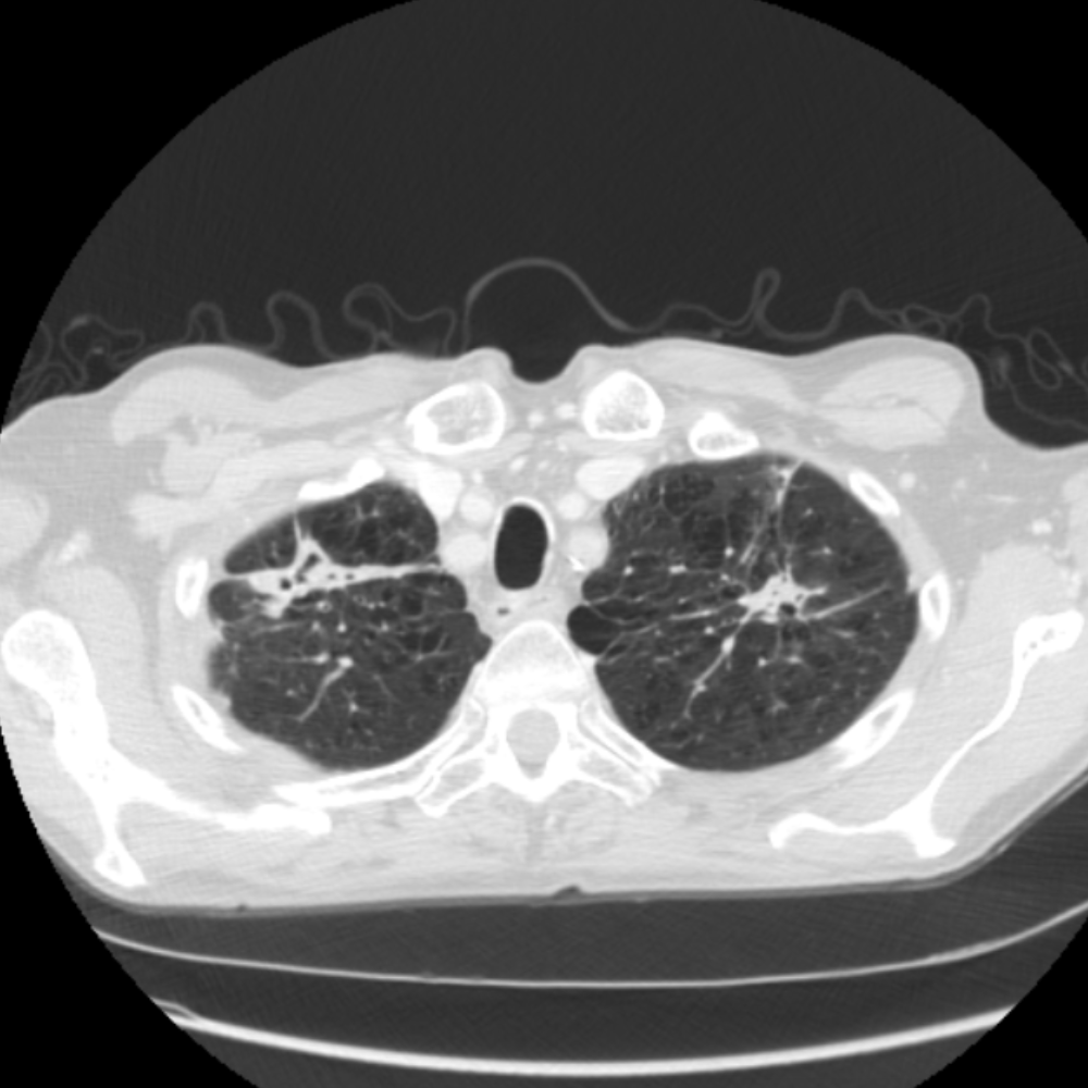 Case #10 - CaseStacks.com