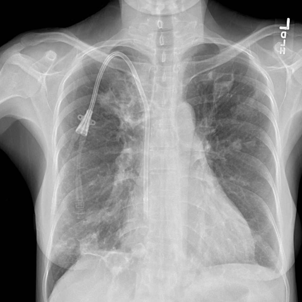 Case #11 - CaseStacks.com