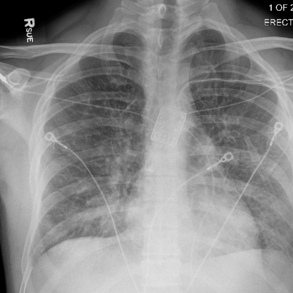 Case #11 - CaseStacks.com