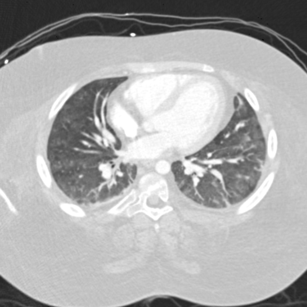 Case #12 - CaseStacks.com