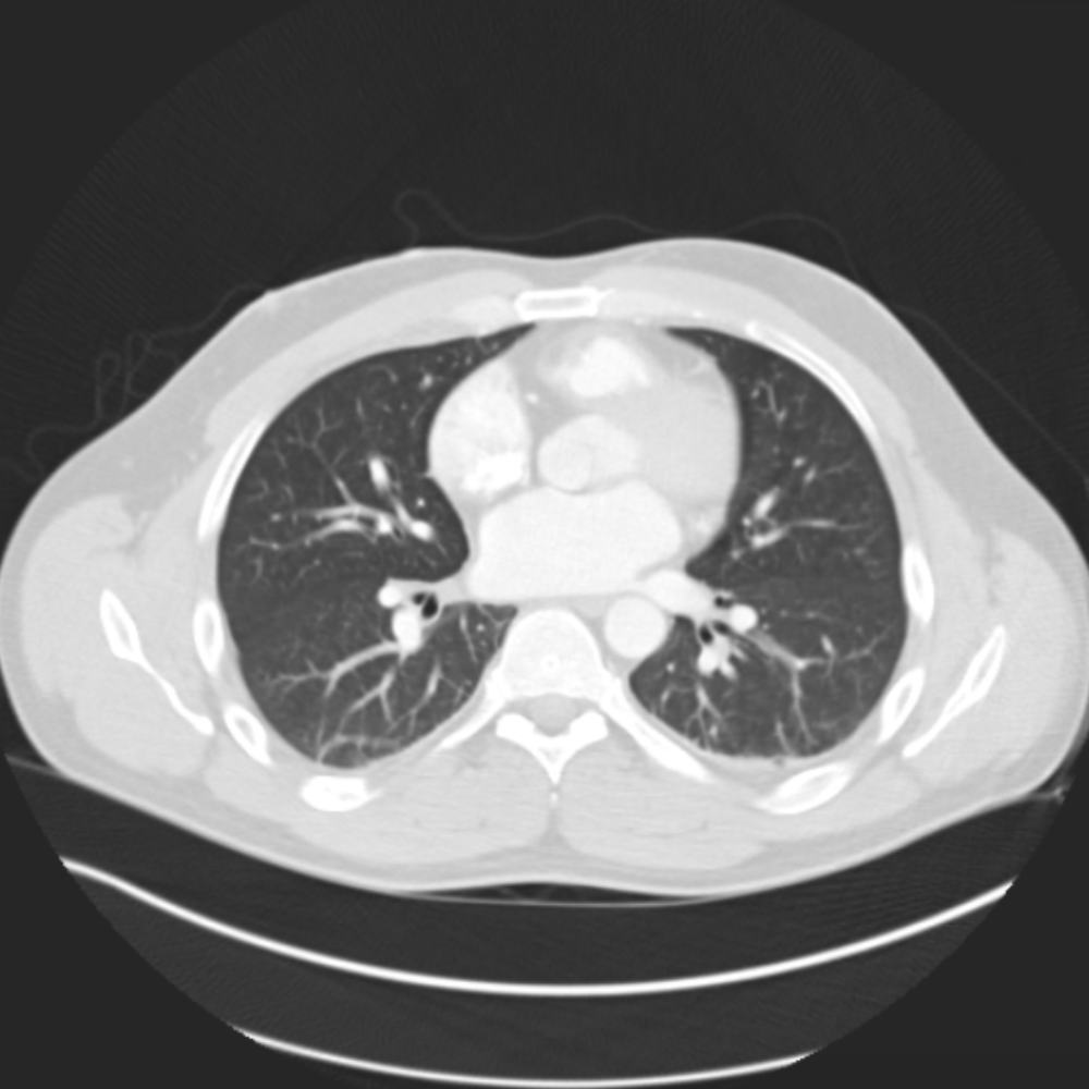 Case #12 - CaseStacks.com