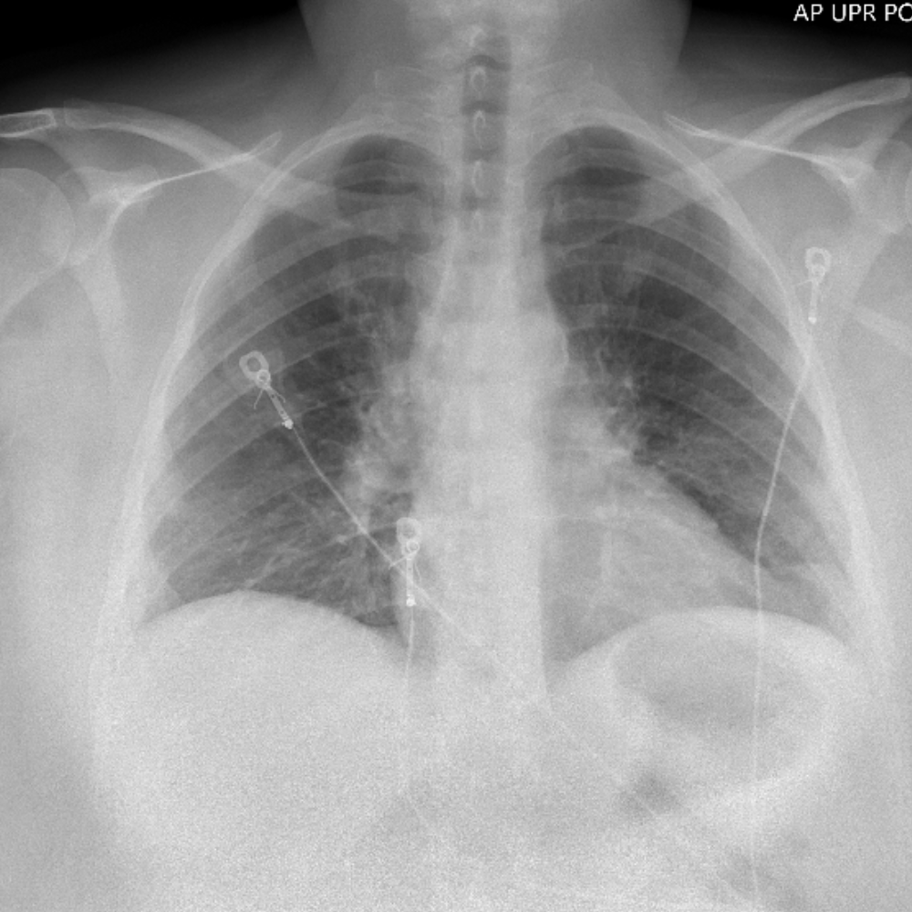 Case #13 - CaseStacks.com