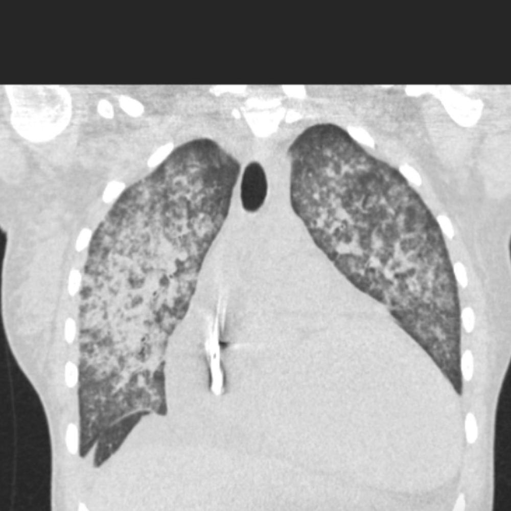 Case #13 - CaseStacks.com