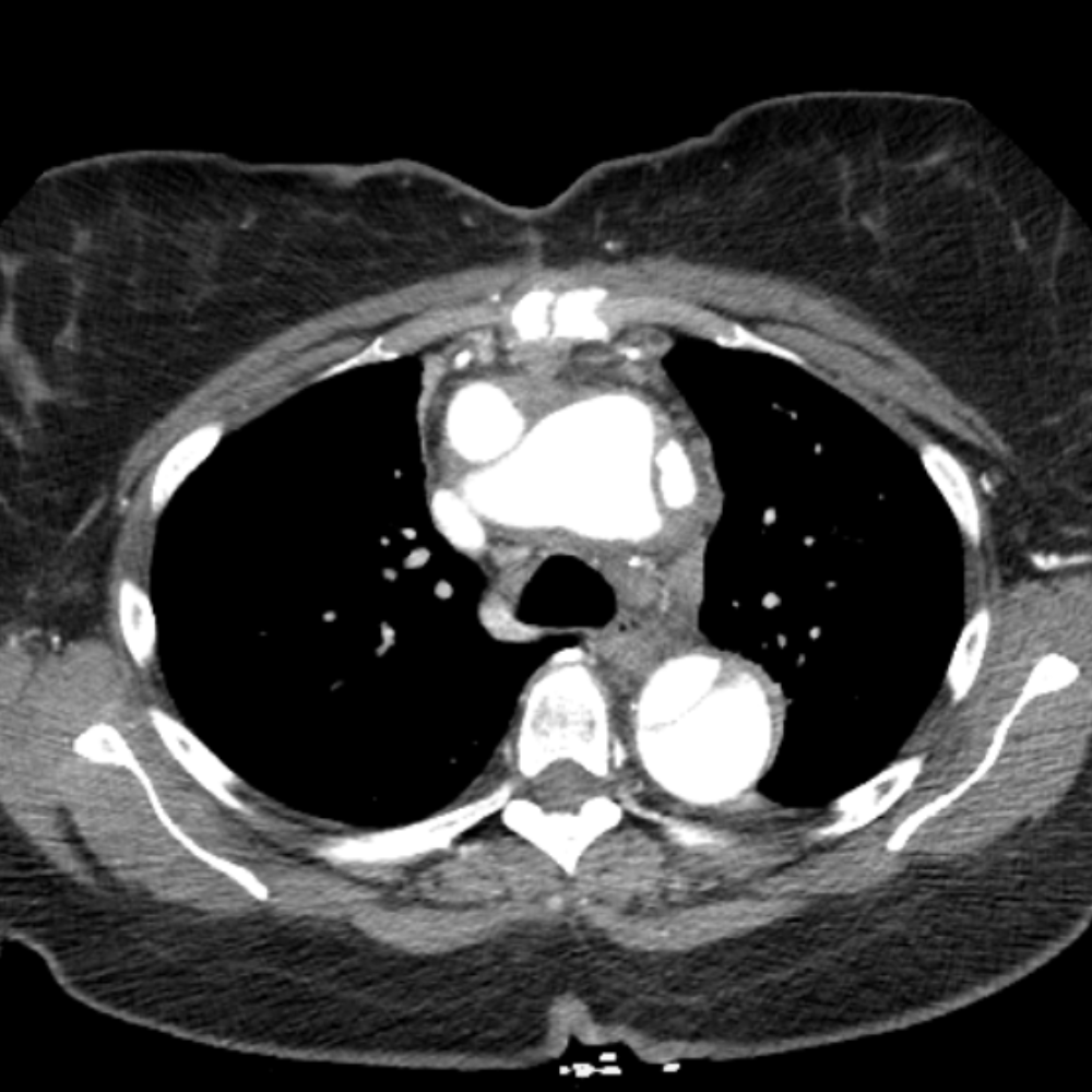 Case #15 - CaseStacks.com
