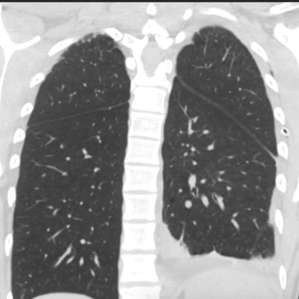 Case #20 - CaseStacks.com