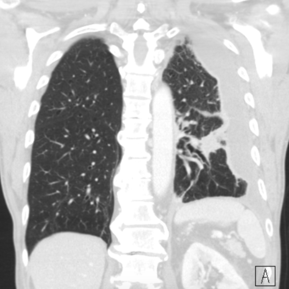 Case #19 - CaseStacks.com