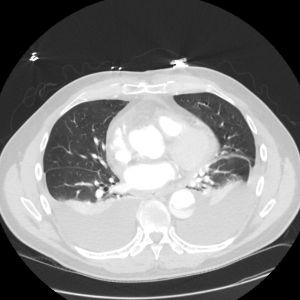 Case #21 - CaseStacks.com