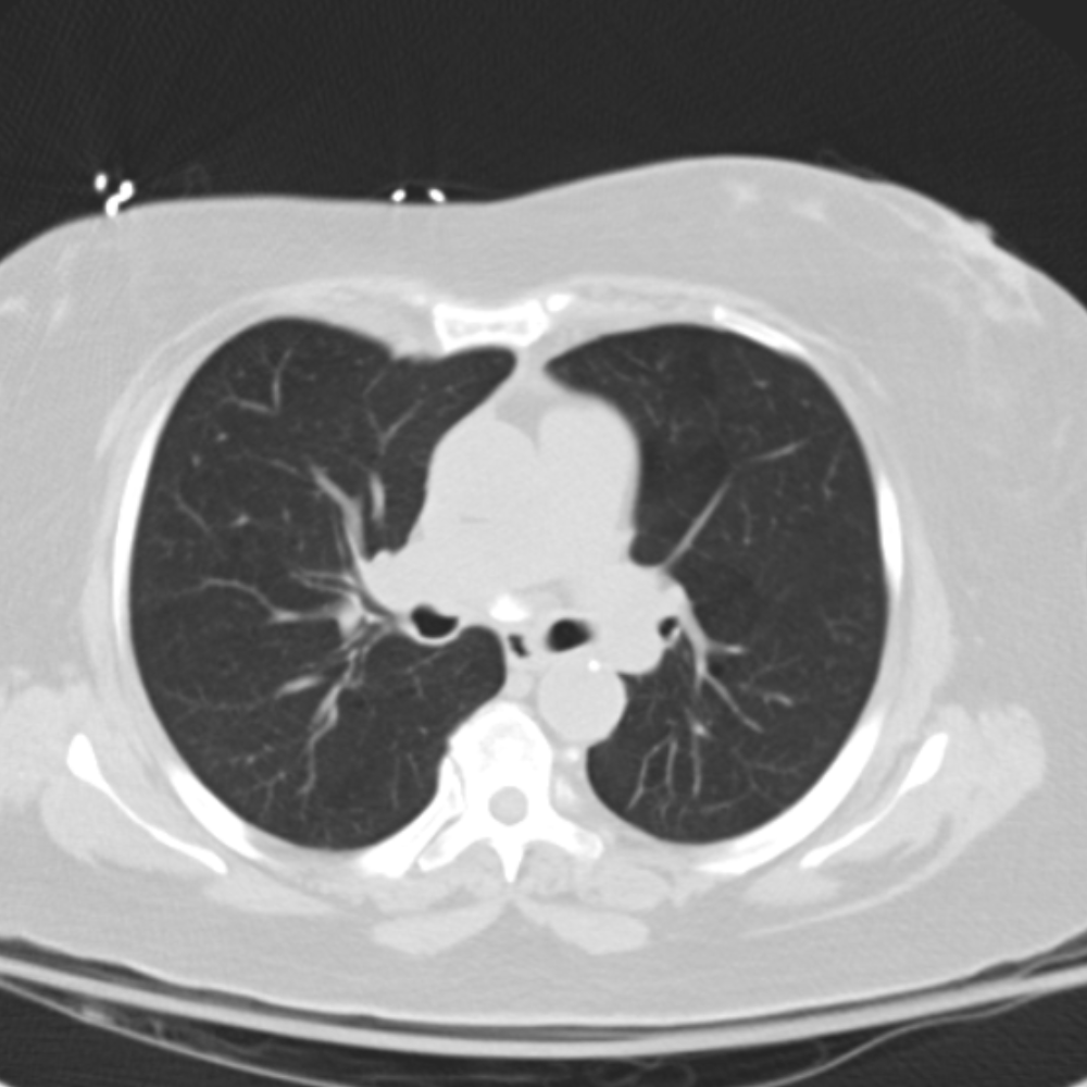 Case #25 - CaseStacks.com