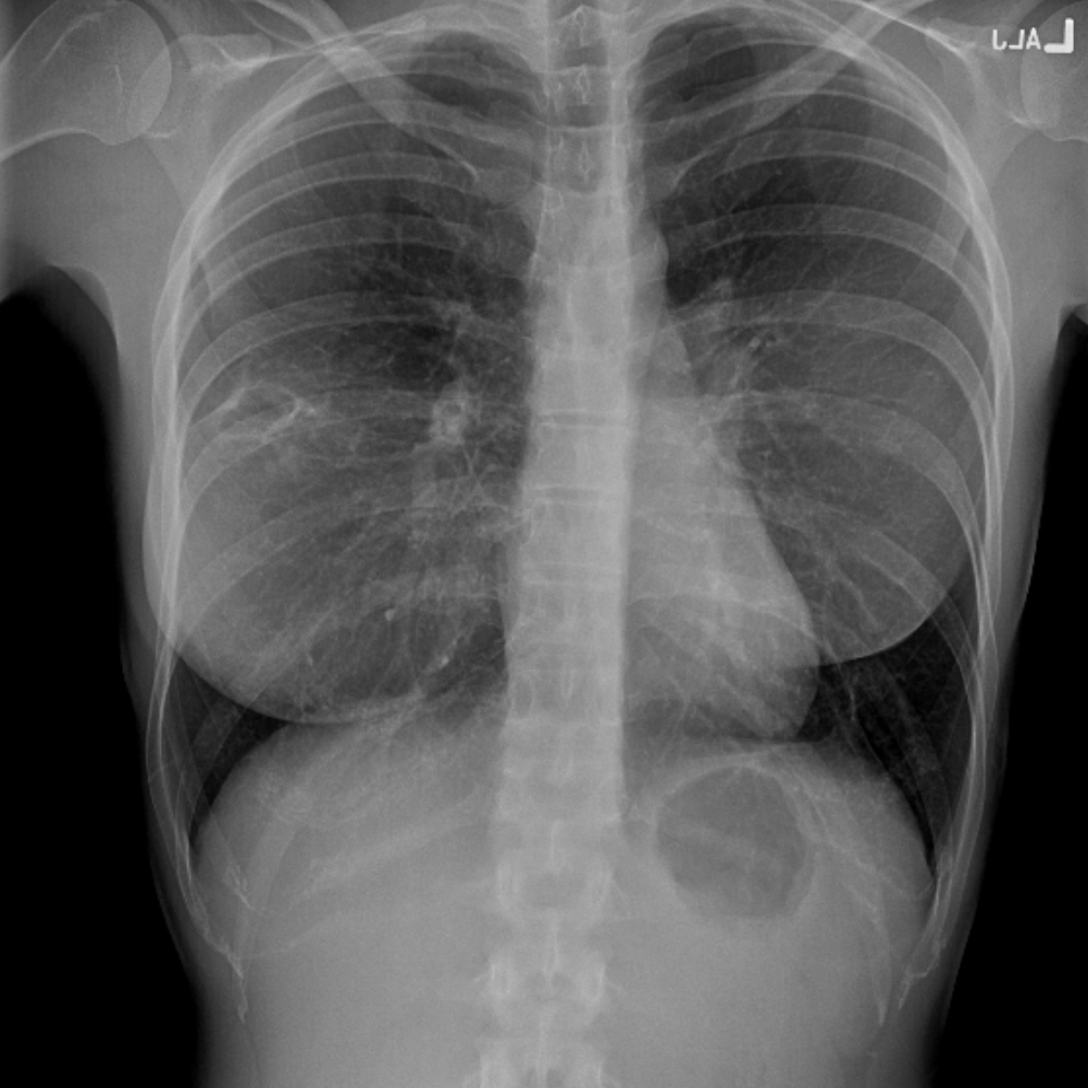 Case #26 - CaseStacks.com