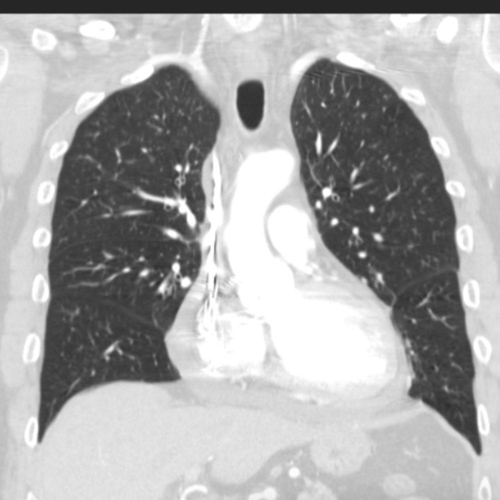Case #28 - CaseStacks.com