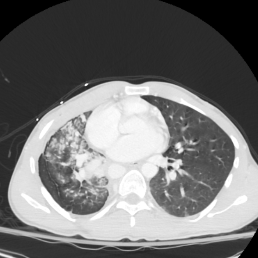 Case #28 - CaseStacks.com