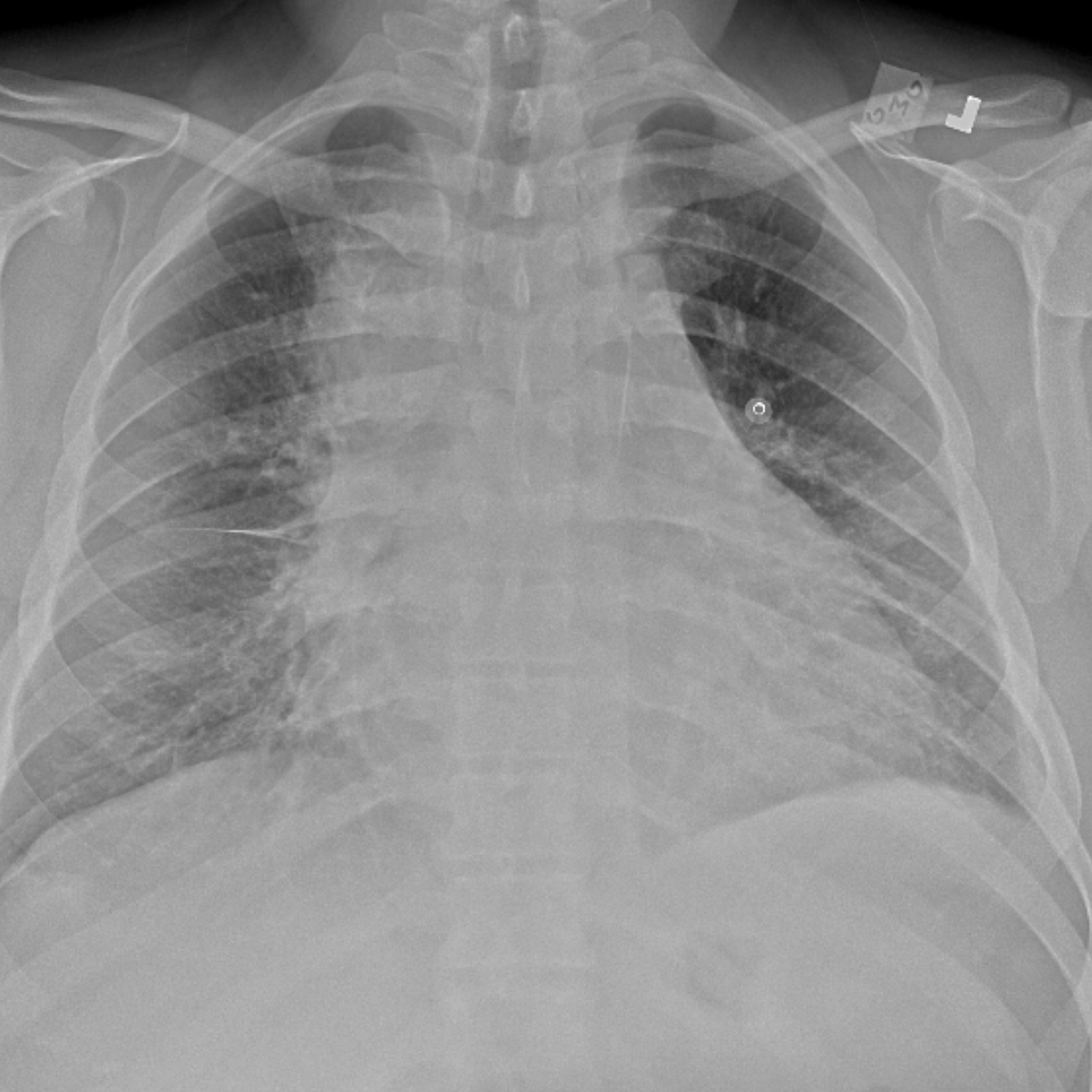 Case #29 - CaseStacks.com