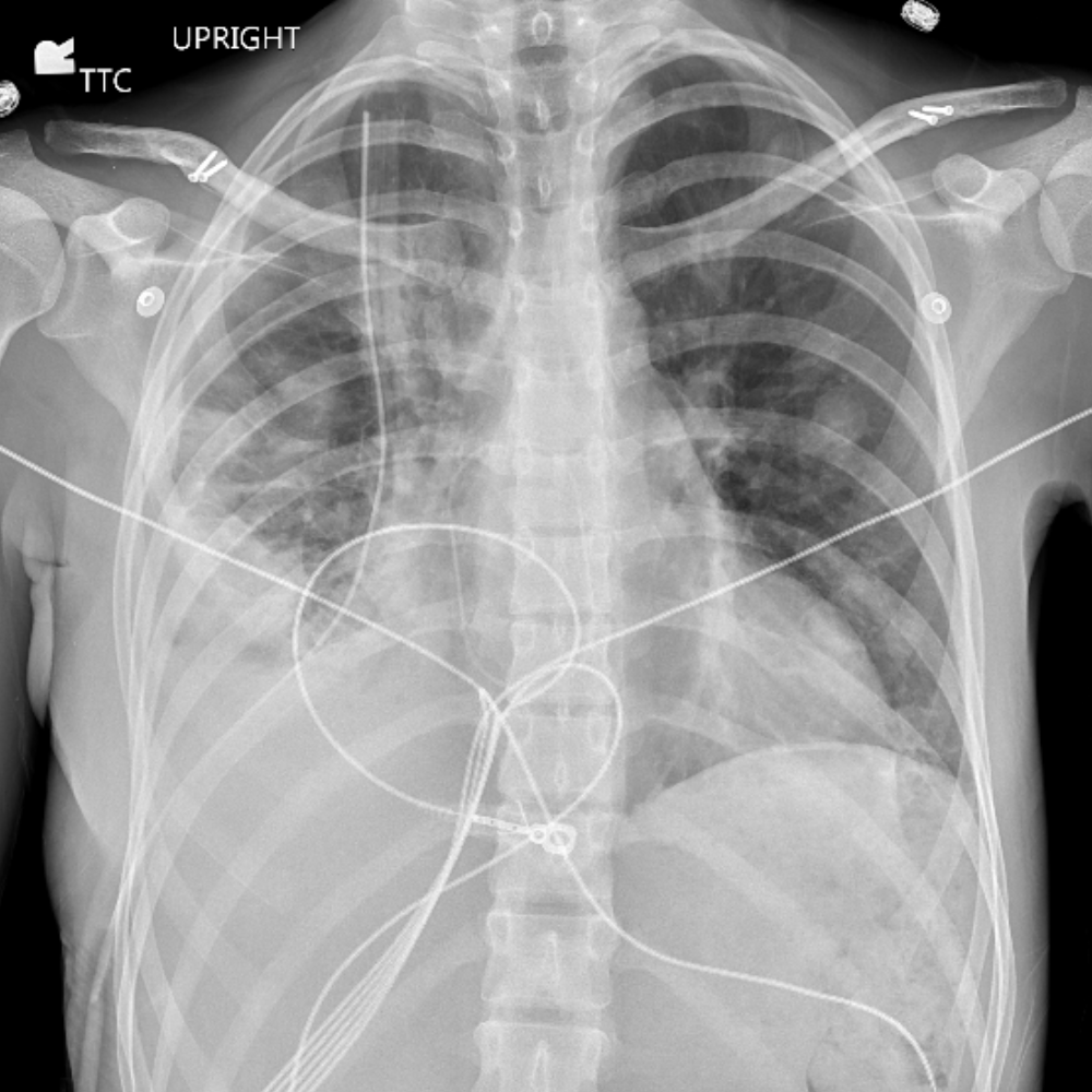 Case #30 - CaseStacks.com