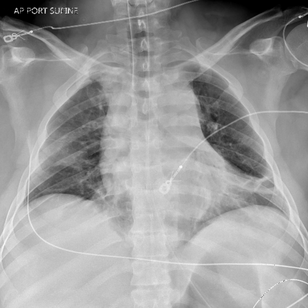 Case #31 - CaseStacks.com