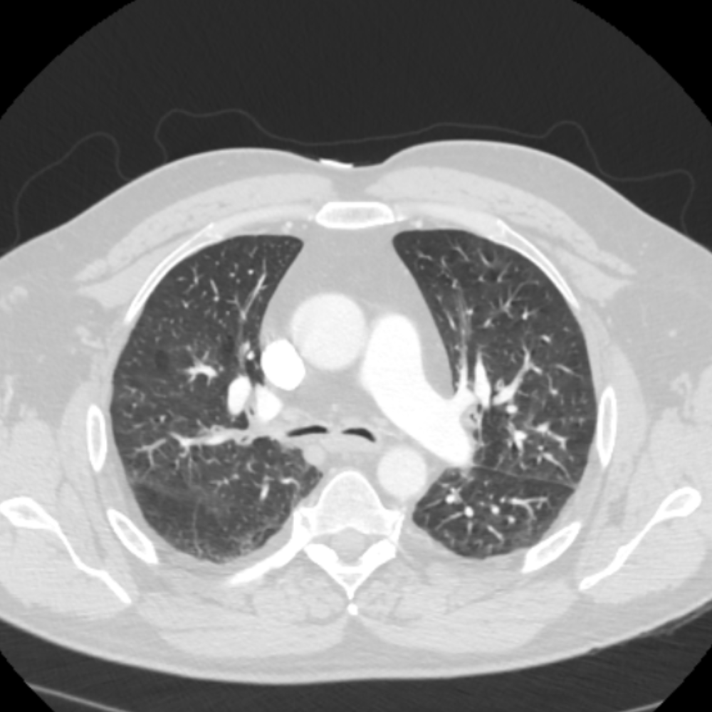 Case #37 - CaseStacks.com