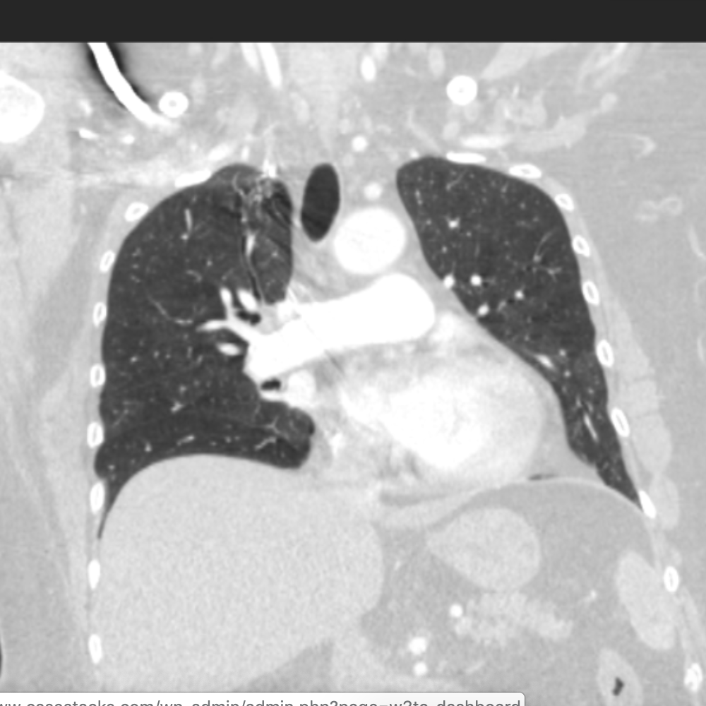 Case #4 - CaseStacks.com