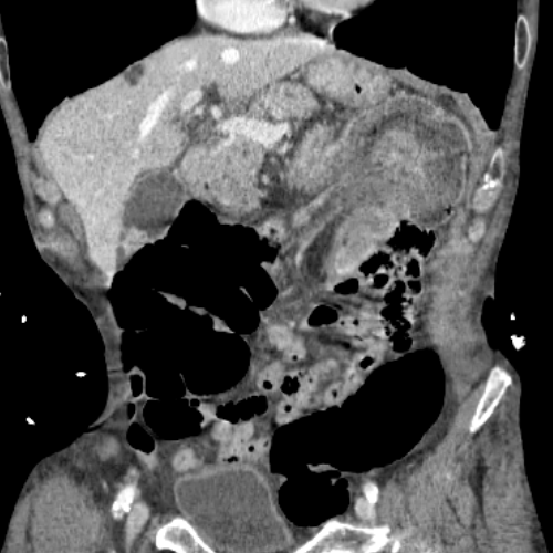 Case #21 - CaseStacks.com