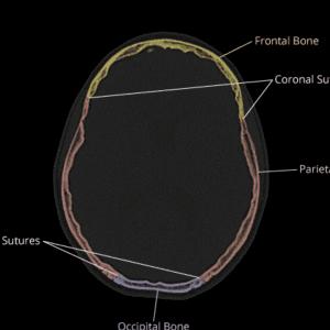 Brain Anatomy Modules | CaseStacks.com