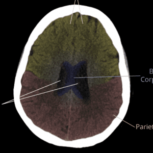 Brain Anatomy Modules | CaseStacks.com
