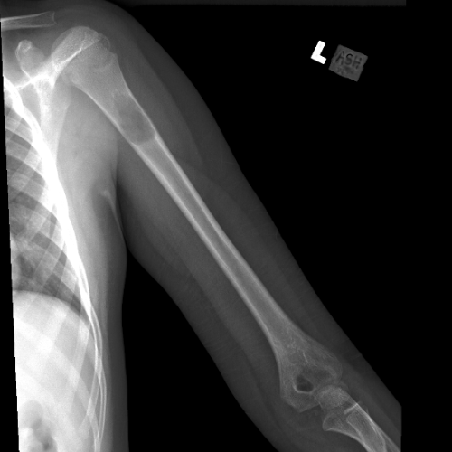 Case #29 - CaseStacks.com