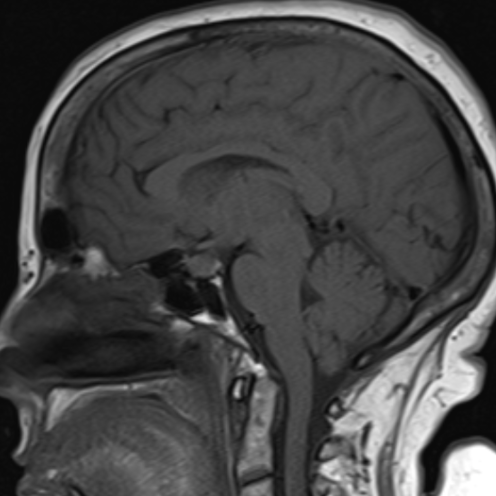 Case #11 - CaseStacks.com