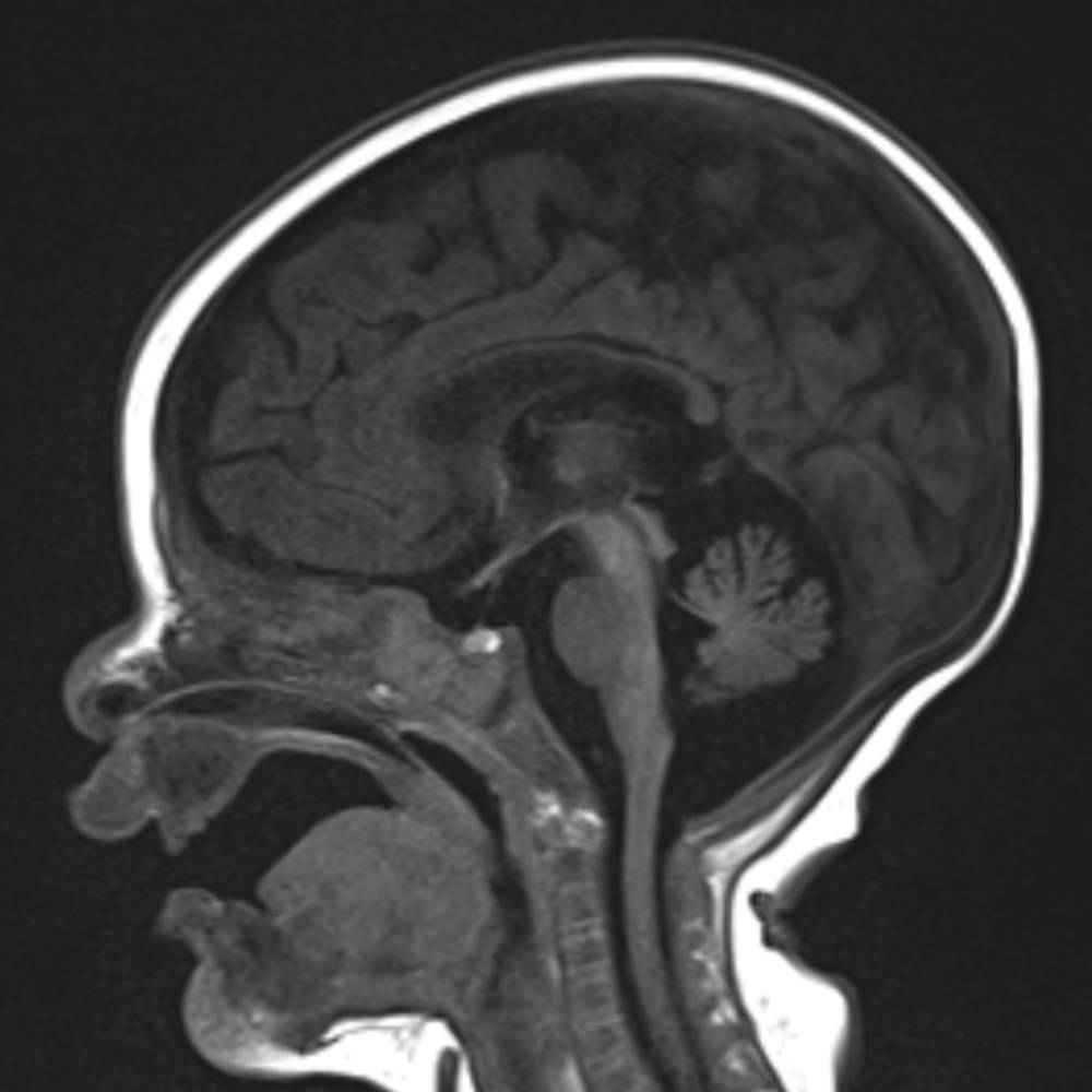 Case #12 - CaseStacks.com