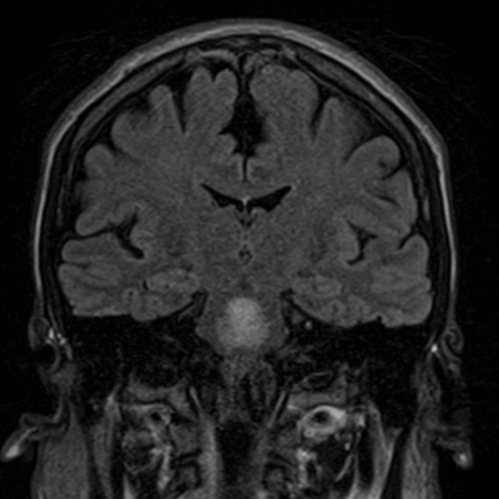 Case #15 - CaseStacks.com