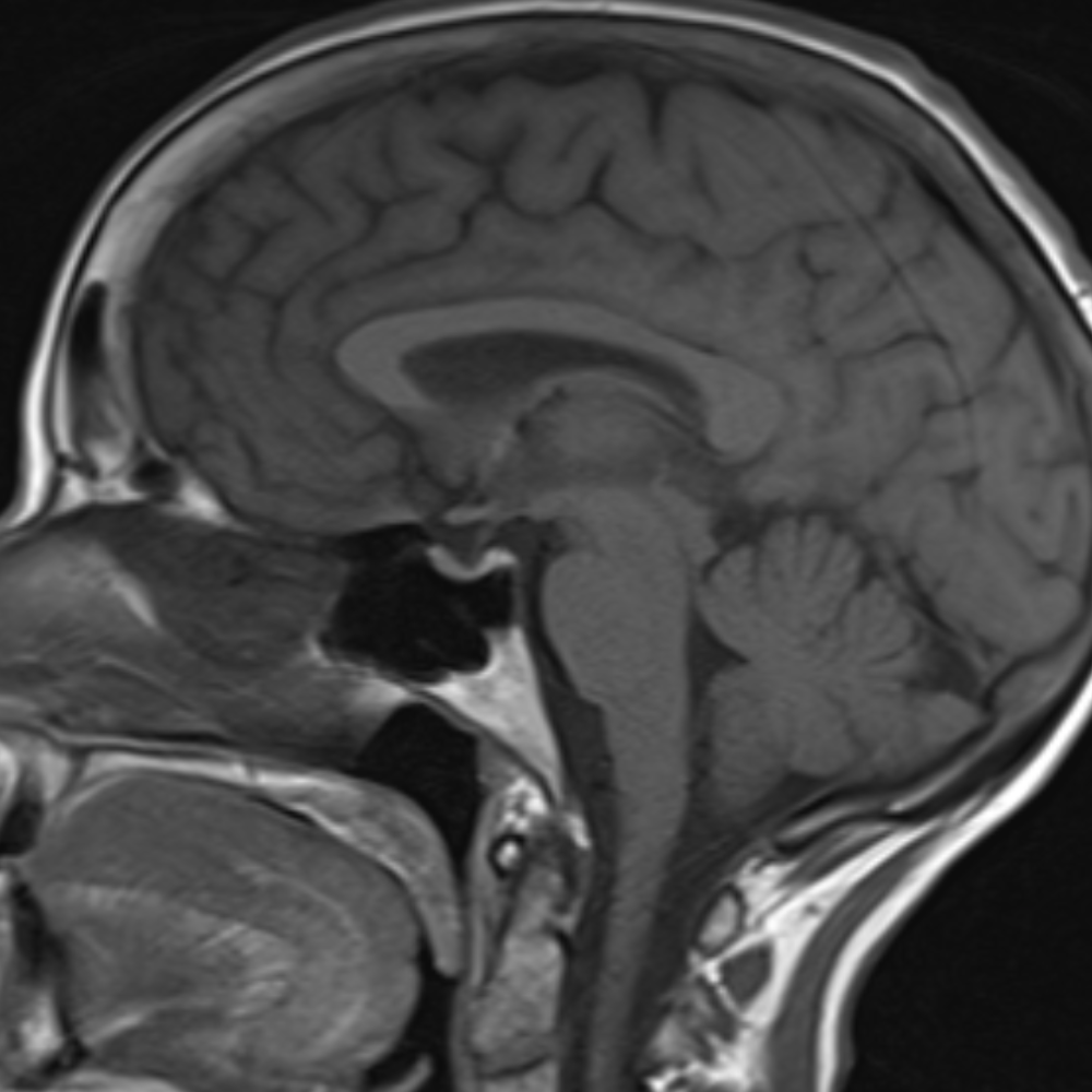 Case #20 - CaseStacks.com