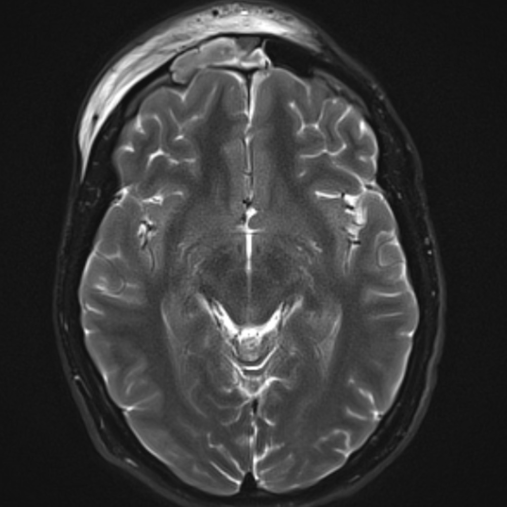 Case #32 - CaseStacks.com