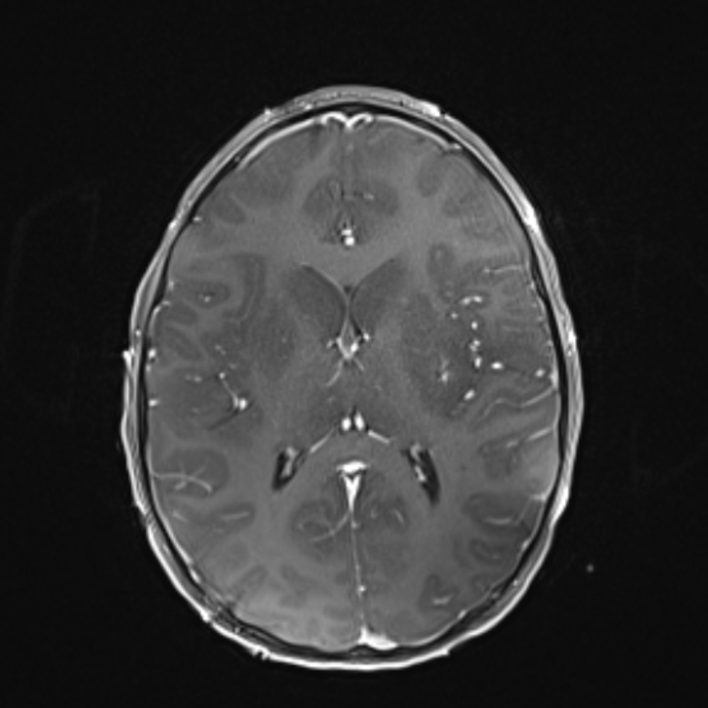 Case #35 - CaseStacks.com
