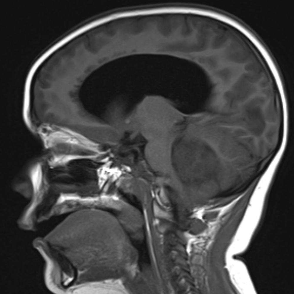 Case #36 - CaseStacks.com