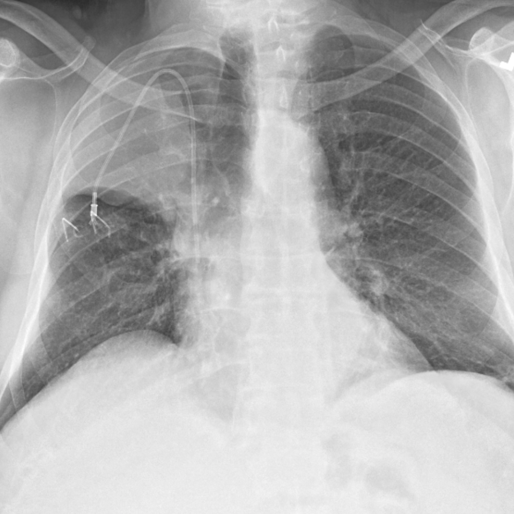 Case #1 - CaseStacks.com