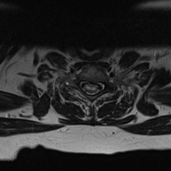 Case #10 - CaseStacks.com